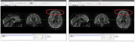 Diffusion Mri Basics Visualization And Preprocessing Mri On Bear