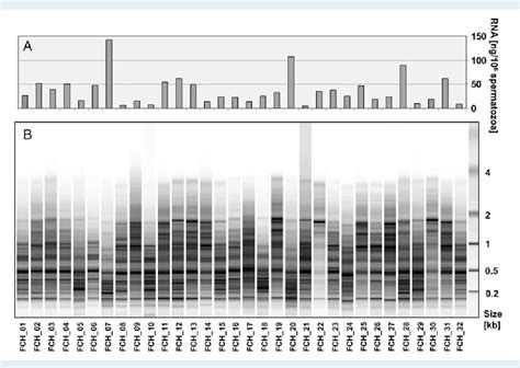 Figure 1 From Highly Purified Spermatozoal Rna Obtained By A Novel Method Indicates An Unusual