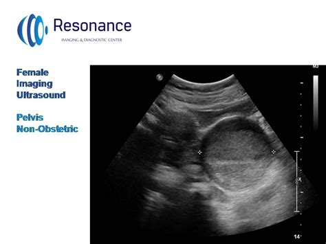 Resonance Imaging And Diagnostic Center Ultrasound Imaging Of Pelvis Nonobstetric Is Done