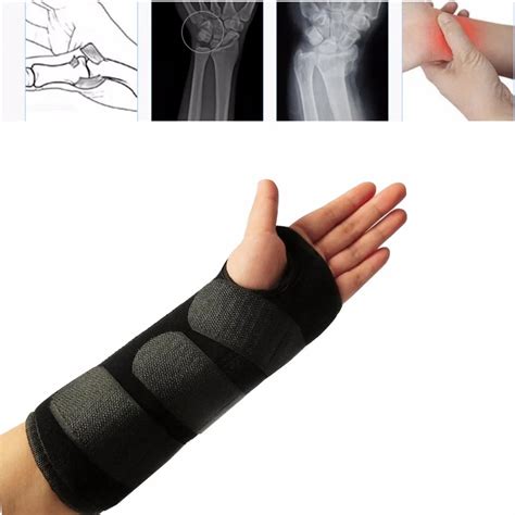 Ulna Bone Fracture