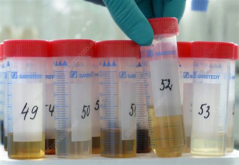 Lab Samples Stock Image C Science Photo Library