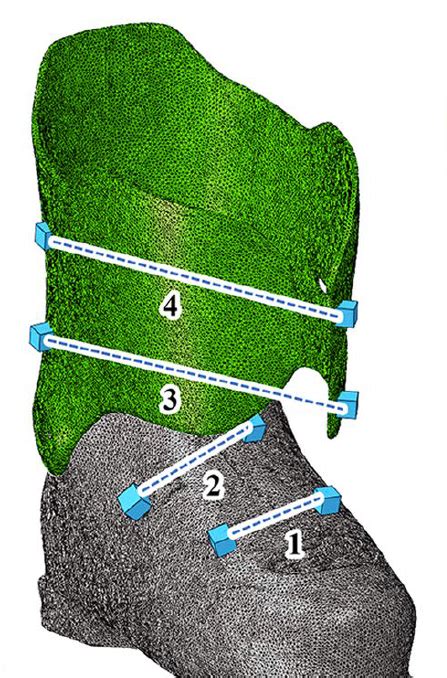 Can 1d Rigids Of Variable Length Be Created — Altair Community