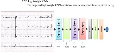 Figure 7 From Efficient Classification Of Ecg Images Using A