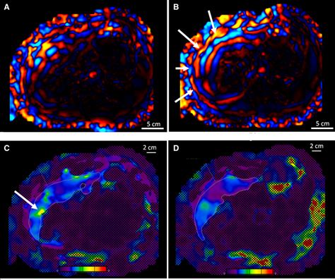 A Comparison Of The Wave Propagation In The Liver Using The Download Scientific Diagram