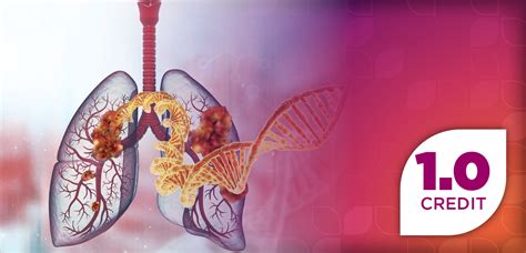 Nccn Guideline Update In Sclc Adds Maintenance Lurbinectedin Removes Chemotherapy Free Interval