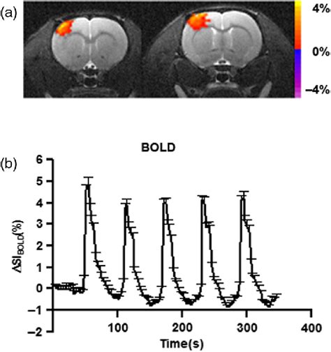 A Bold Fmri Activation Map During Right Forepaw Stimulation Download Scientific Diagram