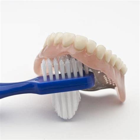 Valplast Partial Denture Framework — Stomadent Dental Laboratory