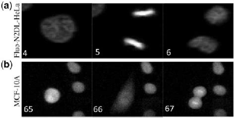 Figure 1 From Fully Unsupervised Symmetry Based Mitosis Detection In