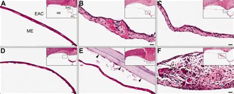 Photomicrographs Of Histological Sections Of A Normal Tympanic