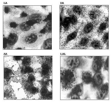 Adherence Patterns Of Enteropathogenic Escherichia Coli Epec Strains Download Scientific