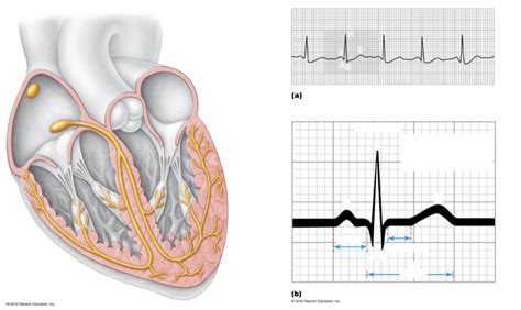 Ecg Waves Diagram Quizlet