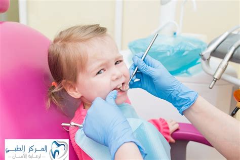 ما هو علاج تسوس الأسنان الأمامية عند الأطفال وتفاصيل تكلفته في مصر