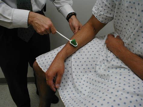 Brachioradialis Reflex