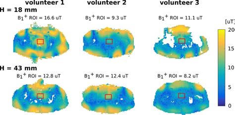 B 1 Maps Of The 8 Element Array With Different Antenna Subject
