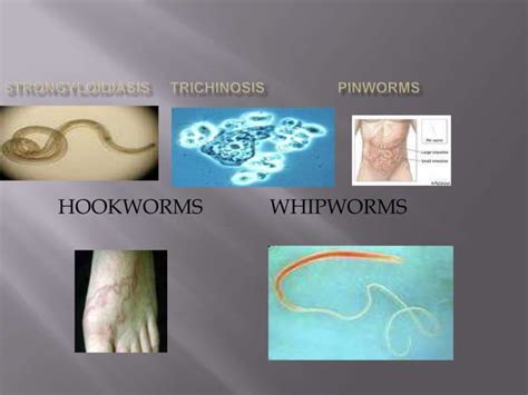 Roundworms Ascaris Pptx