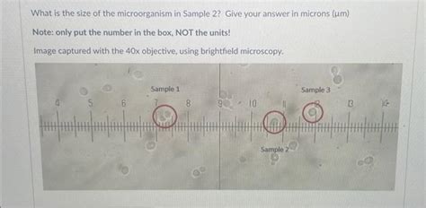 Solved What Is The Size Of The Microorganism In Sample 2