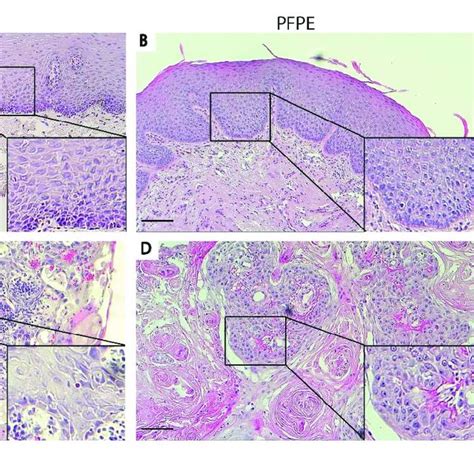 Morphological Comparisons Of Pfpe And Ffpe Tissues Hematoxylin And Download Scientific Diagram