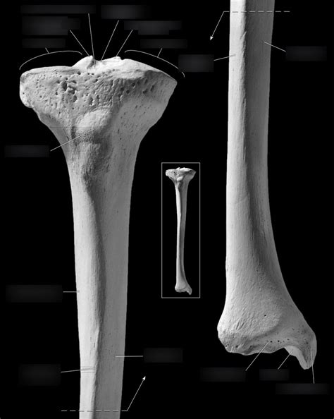 Diagram Of Right Tibia Anterior Quizlet