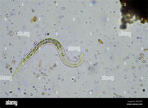 Bacterial Feeding Soil Nematode In A Soil Sample Under The Microscope
