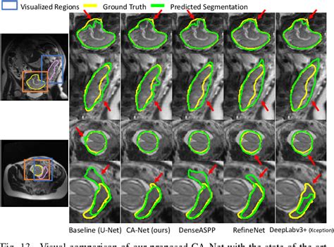 [pdf] ca net comprehensive attention convolutional neural networks for