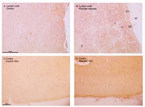10 immunohistochemical staining of cd8 in a control lymph node a a