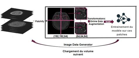 Aneurysm Segmentation — 3d Mri Images By Pierre Samaha Medium