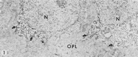 13 D Unstained Embryonic Retina Opl Outer Plexiform Layer N Download Scientific Diagram