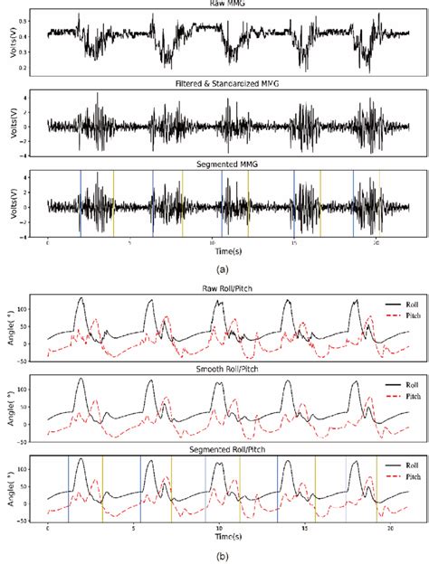 the preprocessing and segmented of the signal of knee extension a mmg