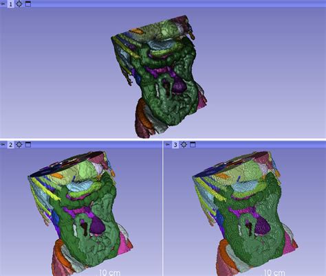 Volume Rendering Colorized With Segmentation Development 3d Slicer
