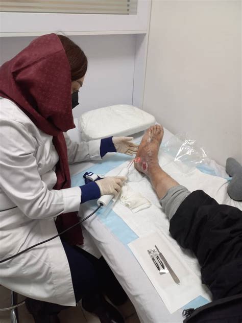 درمان و پانسمان انواع زخم و زخم بستر وکیوم تراپی و اوزون تراپی و