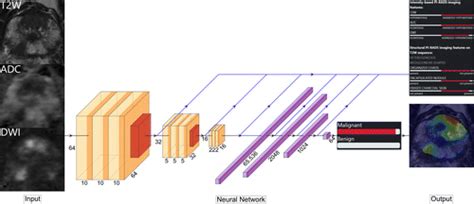 Interactive Explainable Deep Learning Model Informs Prostate Cancer
