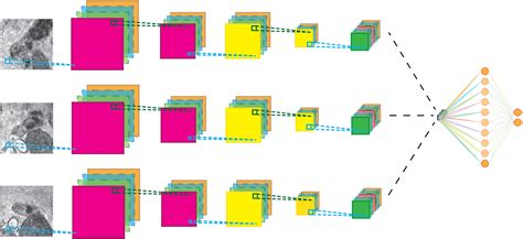 Lymph Node Detection In MR Lymphography False Positive Reduction Using Multi View Convolutional