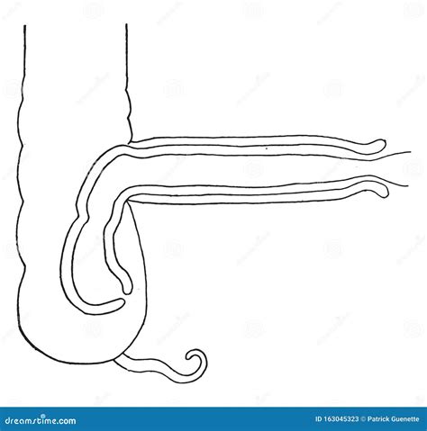 Intussusception Cartoons Illustrations And Vector Stock Images 11