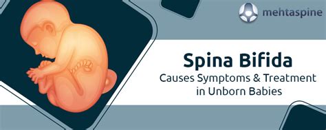 Spina Bifida