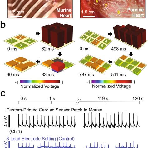 Spatiotemporal Recording Of Epicardial Ecg Signals In Vivo A
