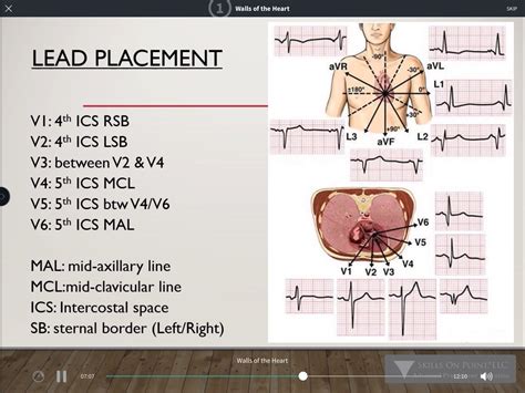 What Is A Normal 12 Lead Ecg at Paul Jamison blog