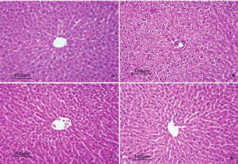 Liver Slide Histology
