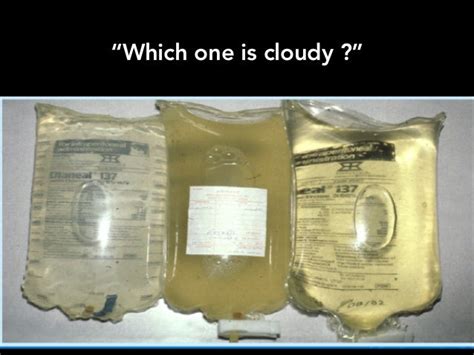 Hand Out Culture Negative Peritonitis Feb 2018 Baxter Scientia