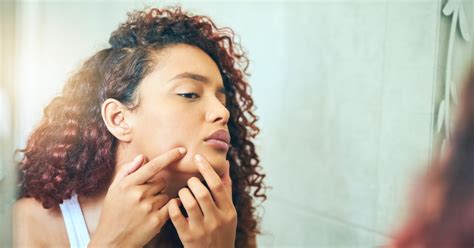 What To Put On Pimples Overnight PS Beauty