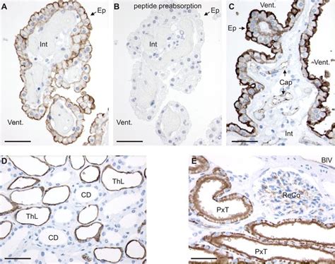 Immunolocalization Of Aquaporin Aqp 1 To The Human Choroid Plexus A Download Scientific