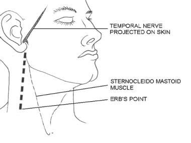 Erb Point S Anatomy