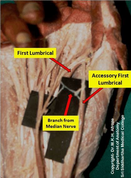 Lumbricals Innervation
