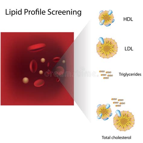 Lipid Profile Blood Test Stock Vector Illustration Of Lipid