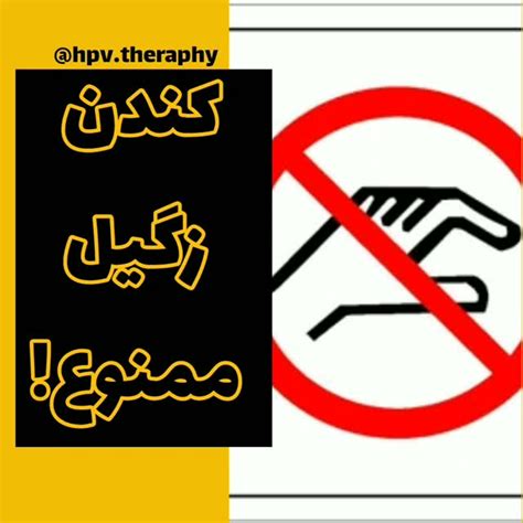 ‎💎کلینیک آنلاین الماسدرمان قطعی زگیل و تبخال تناسلی 💎‎ ‎نگو که توام