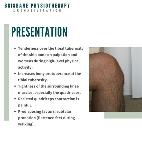 Tibial Tubercle Palpation