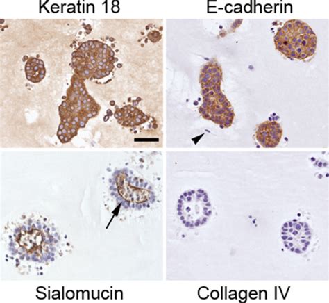Characterization Of Epithelial Structures In Mixed Matrigel™ Collagen