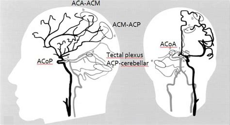 Variations Of Circle Of Willis Hypoplastic Posterior Communicationg
