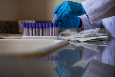 Position Statement On The Global Ncd Agenda — Ncdi Poverty Network