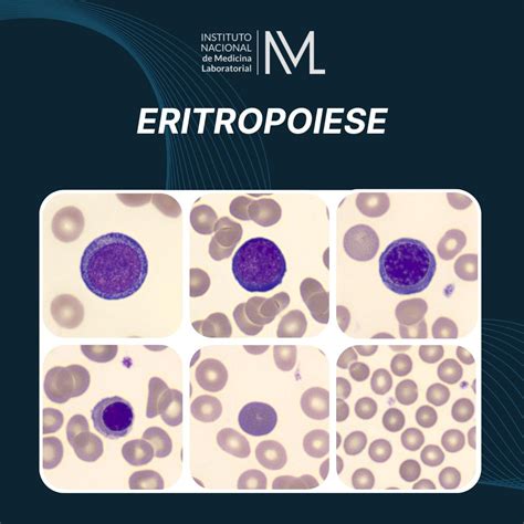 Eritropoiese A Eritropoiese O Processo Vital De Formação Dos Glóbulos Vermelhos é Um Dos