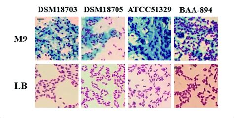 Light Microscopic Observation Of Four Cronobacter Species Grown On